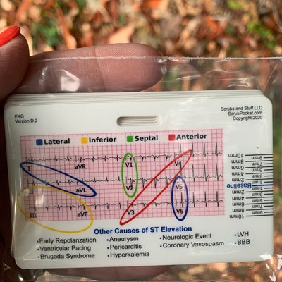 STEMI Reference Tool Horizontal Badge Pocket Card for Nurse Paramedic ...