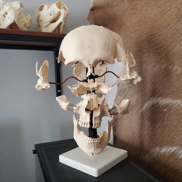 Exploded Human Skull - Beauchene Skull Model - Medical Display Model ...