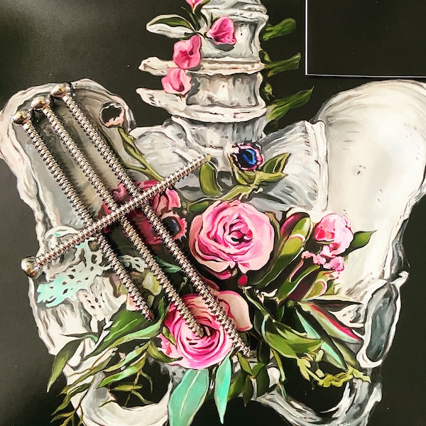 Floral Pelvis Anatomical Art Print - Pelvic Floor With Flowers, Medical ...
