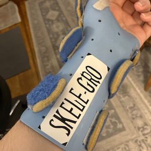 Skele-gro Bottle - Etsy