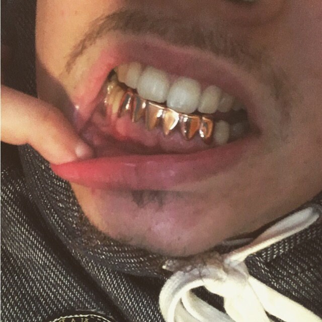 10K Solid Rose Gold Custom Fit REAL Grill Gold Teeth Handmade GRILLZ.
