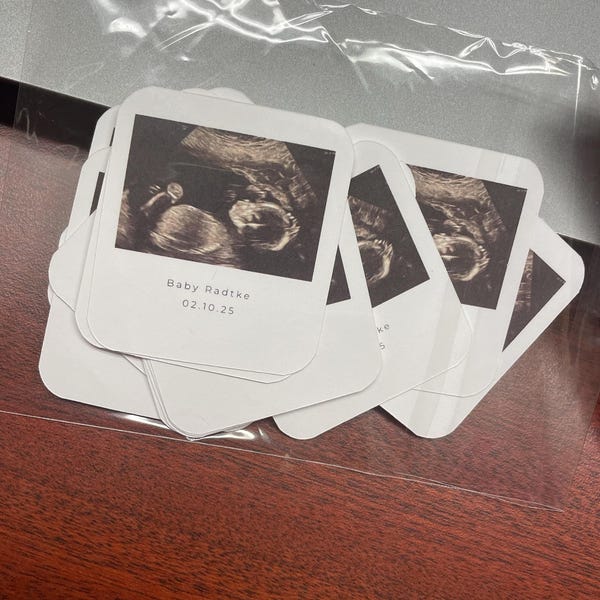 Baby Shower Decorations | Ultrasound Confetti | Custom Decorations Baby ...