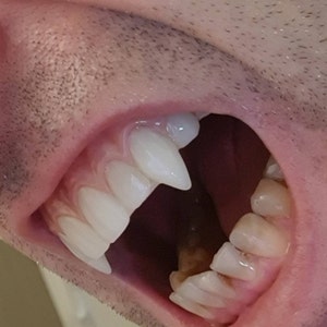 Werewolf / Wolf / Werewolf Teeth / Animal / Natural Wyndigu Teeth ...