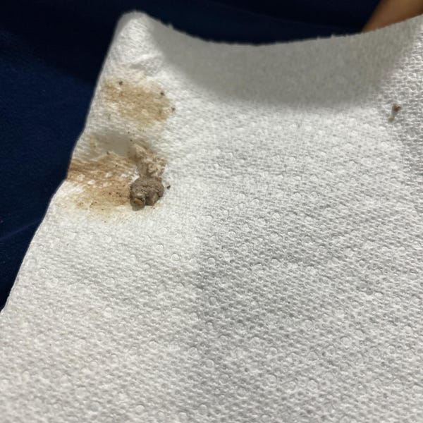 Natural Chewing Sponge,taakotsa,sawie From Ghana (100g) - Etsy