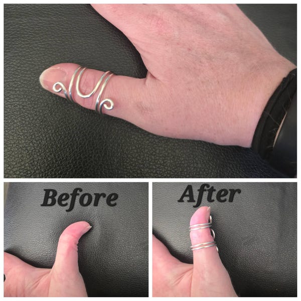 Adjustable Ring Splint | Finger Splint for Lateral Deviation| Joint ...