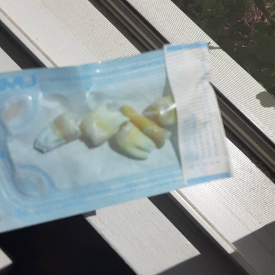 10 Real Human Teeth molars Premolars & Anteriors - Etsy