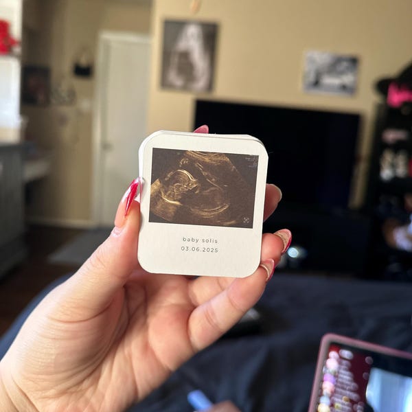 Baby Shower Decorations | Ultrasound Confetti | Custom Decorations Baby ...