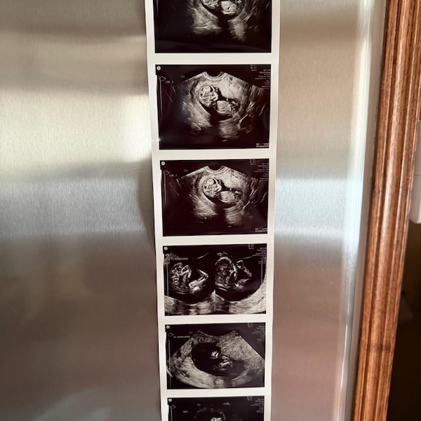 Pregnancy Keepsake - Your Ultrasound Image Print Outs on REAL MEDICAL ...