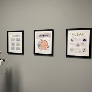 Dry Eye Therapy Dry Eye Poster Educational Optometry Optometry Artwork ...