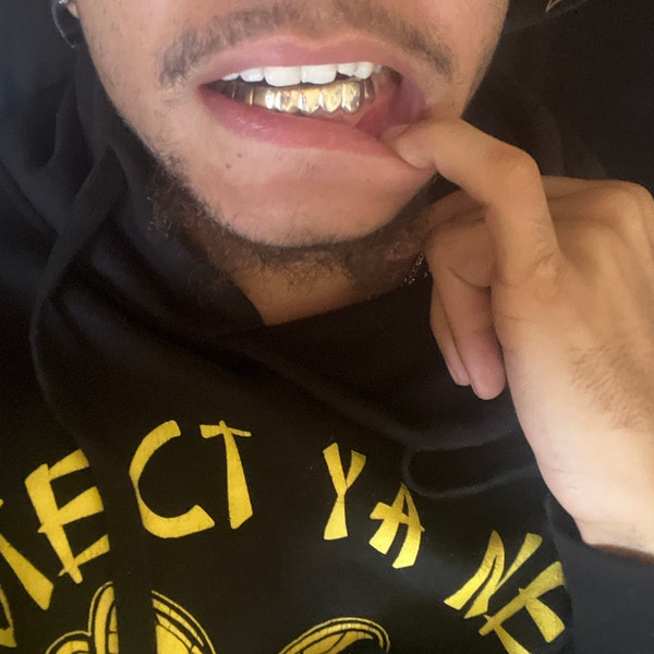 Custom Fit Sterling Silver Grillz: Plain Silver, Gold Plated Teeth - Etsy