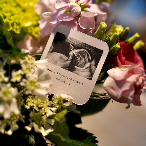 Baby Shower Decorations | Ultrasound Confetti | Custom Decorations Baby ...