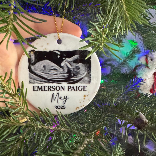Custom Ultrasound Ornament, Ultrasound Photo Gift, Sonography Gifts ...