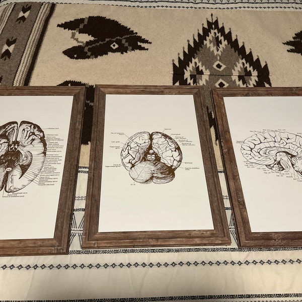 Brain Anatomy Art Foil Print Set of 3 - Medical School - Human Brain ...