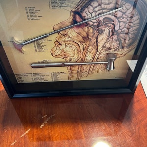 Infant & Child Embalming Trocar / Drain Tube - Etsy