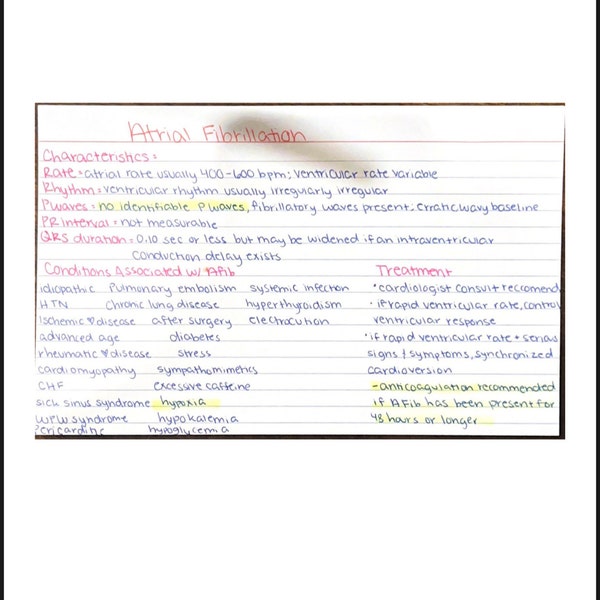 ECG Rhythm Note Cards in a PDF Format - Etsy