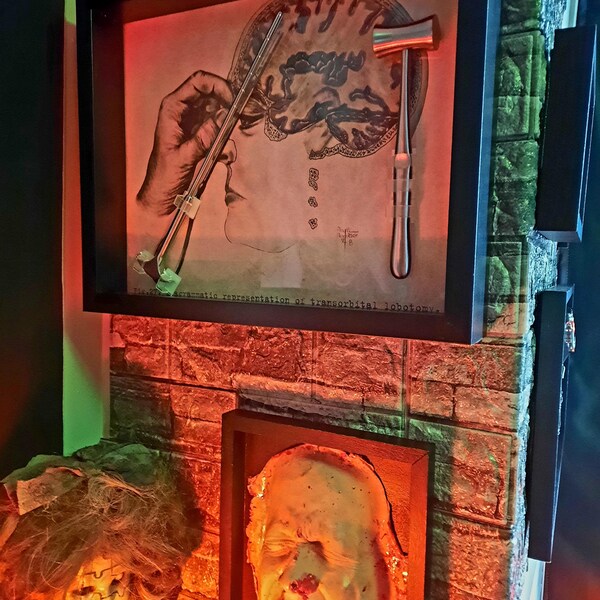 Lobotomy Diagram, Vintage Illustration, Art Print A4 Size - Etsy