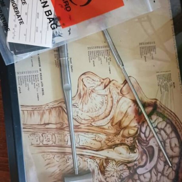 BESTSELLER! Lobotomy Shadowbox Display Large - Etsy