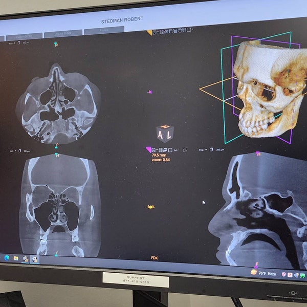 Monster Polka Dot Skater Skirt Blue Purple Fur Pattern Sulley Running ...