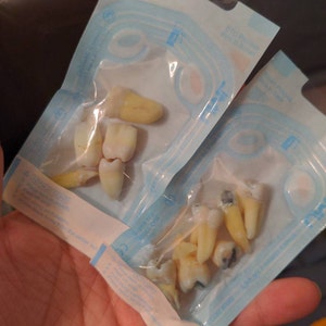 10 CRACKED AND BROKEN Real Human Teeth Molars, Premolars, & Anteriors ...