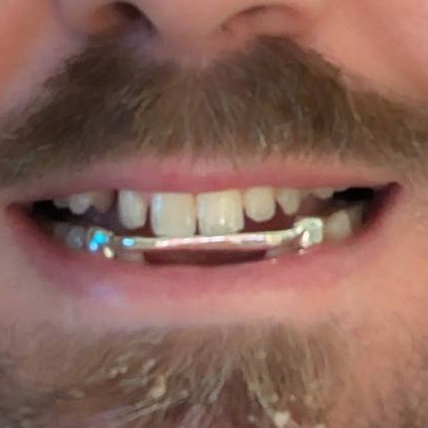 Real Solid 10K Gold or 14K or 18K Gold Single Gap Grill Custom Fit ...