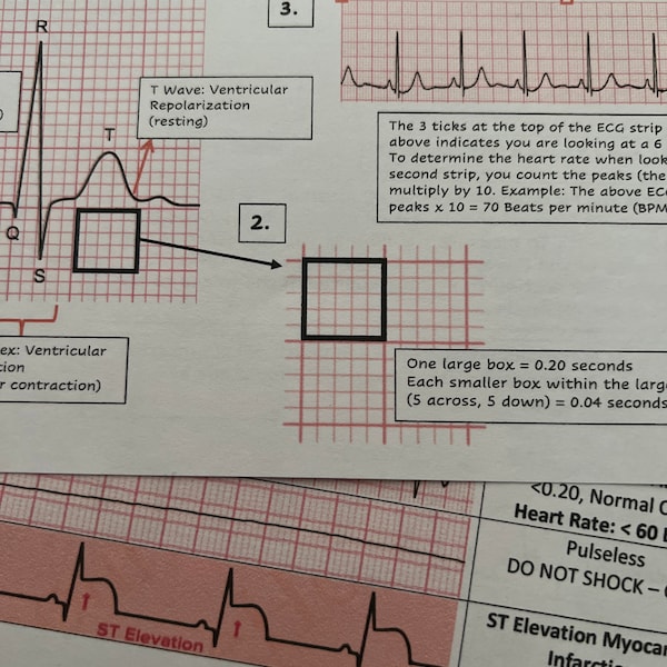 DIGITAL NOTES: Vital Signs + QUIZ - Etsy