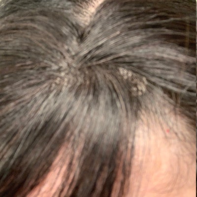 Biological Scalp Toupee Human Hair Extension Clip in Hairpieces Topper ...