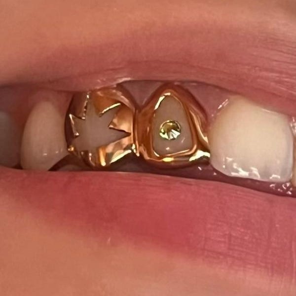 Custom 1 Open Face Tooth Cap Grillz - Etsy