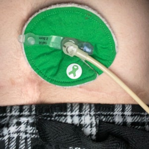 Solid Color Trach Pads Tracheostomy Pad Trach Dressing - Etsy