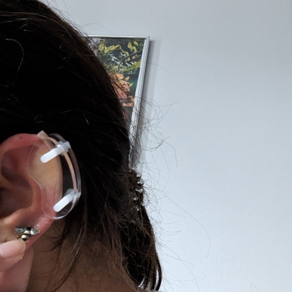 Keloid Compression-'bean' - Etsy