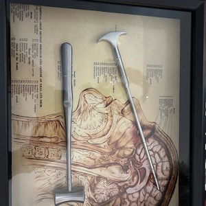 BESTSELLER Lobotomy Shadowbox Display Large - Etsy