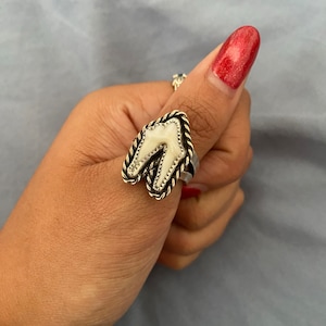 Your Own Custom Tooth Ring - Etsy