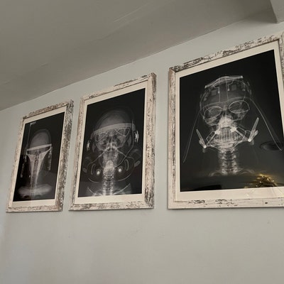 X-ray Fine Art Prints - Etsy