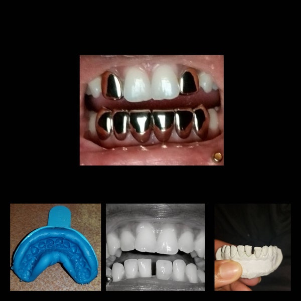 Handmade Custom .925 Sterling Silver Top Fangs With Bottom Wolf Style ...