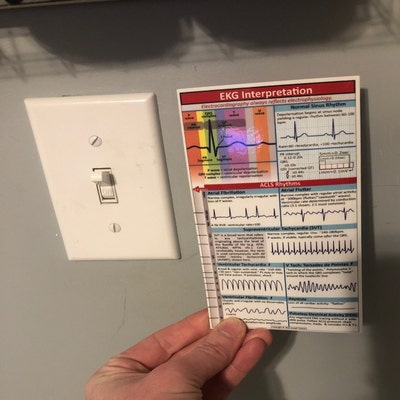 EKG Pocket Guide - Etsy