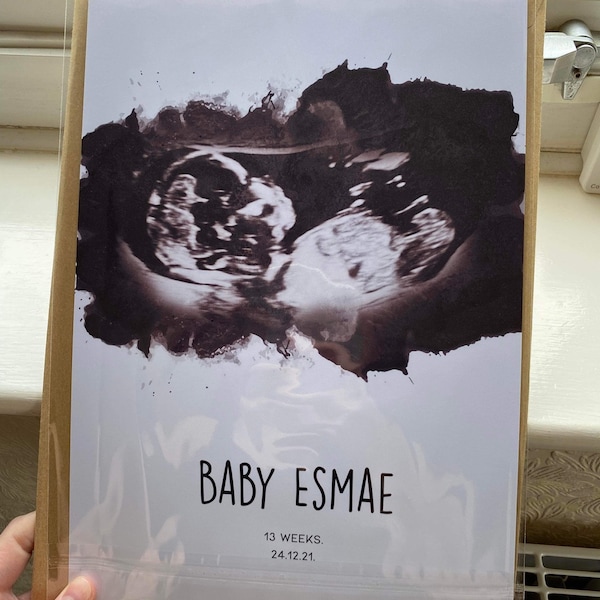 Personalised BABY Scan Ultrasound Watercolour Print 4D First Baby Scan ...