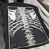 Ribcage Back Patch, Ribcage, Skeleton Patch, Bones Patch, Cloth Patch, Spine, Back Patch, Canvas ...