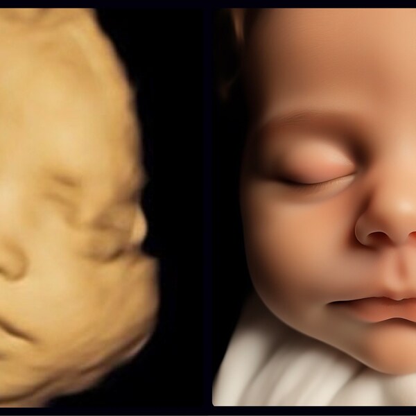 Ultrasaund 8k Baby Image 3d 4d 5d 8d Real View Baby AI Photo ...