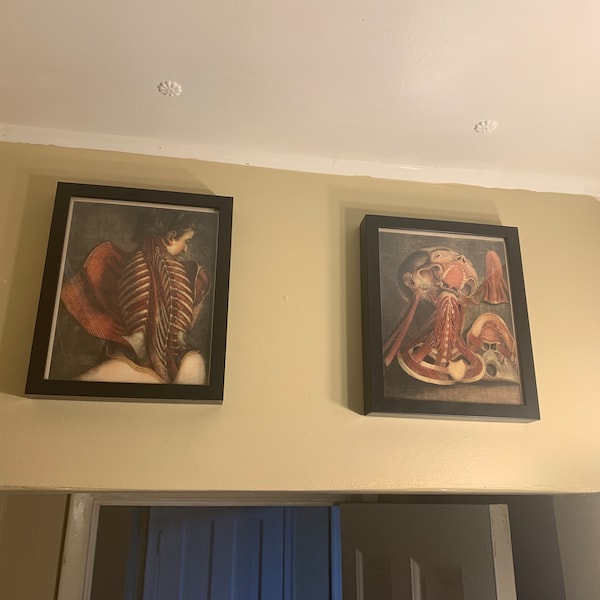 His and Hers Cadavers • Antique Anatomy Wall Art • Set of 2 8X10 Prints ...