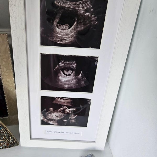 Baby Scan Photo Frame - Multi Aperture Frame for Three Scan Sized ...