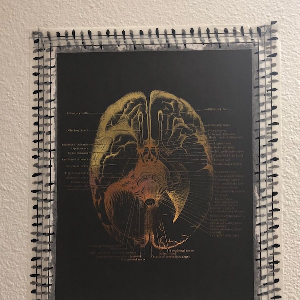 Human Brain Anatomy Medical Student Gift Foil Print - Doctors Office ...