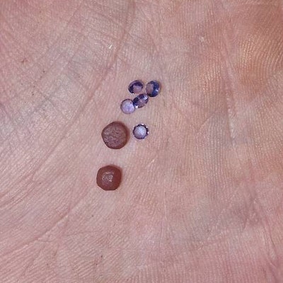 10 Stück natürlicher roher Rubin, Größe 8-13 mm, roter Kristall Rubin ...