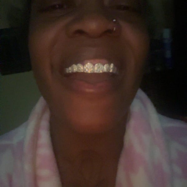 Custom Grillz With Extended K9s and Back Bar - Etsy