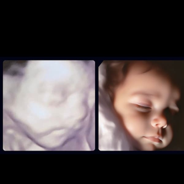 Ultrasaund 8k Baby Image 3d 4d 5d 8d Real View Baby AI Photo ...