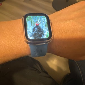 Dental Hygienist Teeth Dentist Engraved Watch Band 38/40/41 Mm 42/44/45 ...