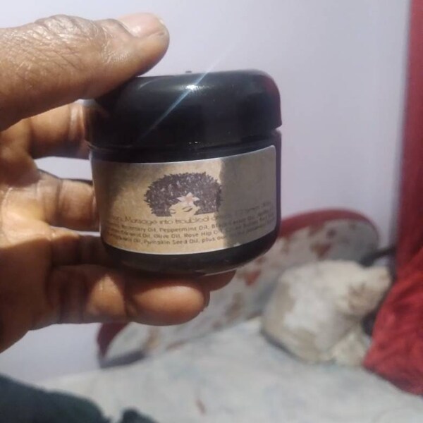 Hair Loss Treatment Hair Growth Cream 1 Month Supply Balding Alopecia ...