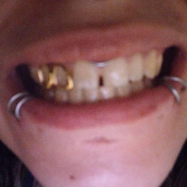 Classic Heart Window Tooth Cap! Custom Grillz, FREE Shipping! - Etsy