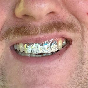 Silver Grillz 925 Sterling Silver Teeth Real Diamond Cut Custom Silver ...