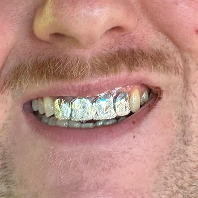 Custom Gold Grillz 10k Gold Teeth Open Face Yellow Grillz Real Gold ...