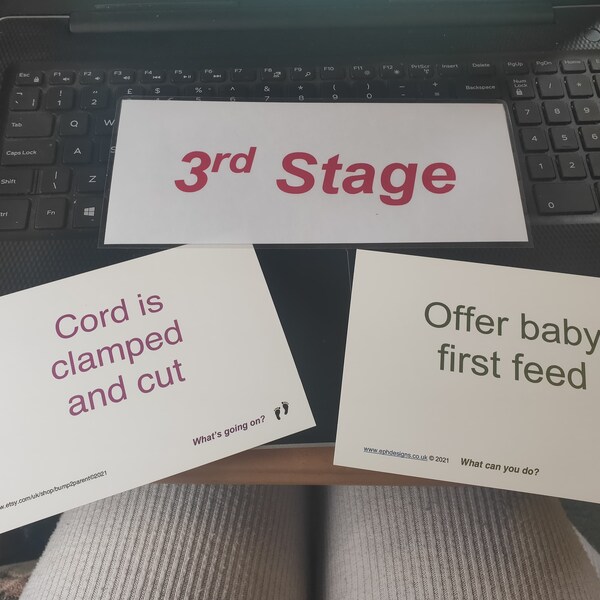 What Happens to Baby's Cord A3 Poster - Parentcraft/antenatal Teaching ...