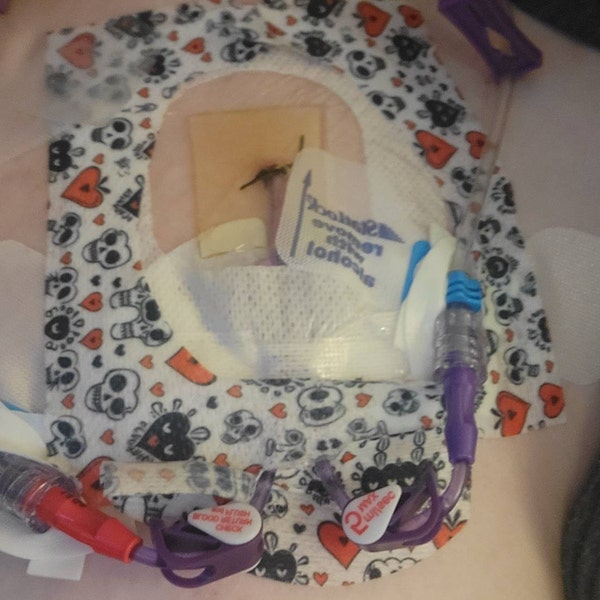 Ehlers Danlos Syndrome Awareness Sticker | EDS Awareness | Zebra Stripe ...